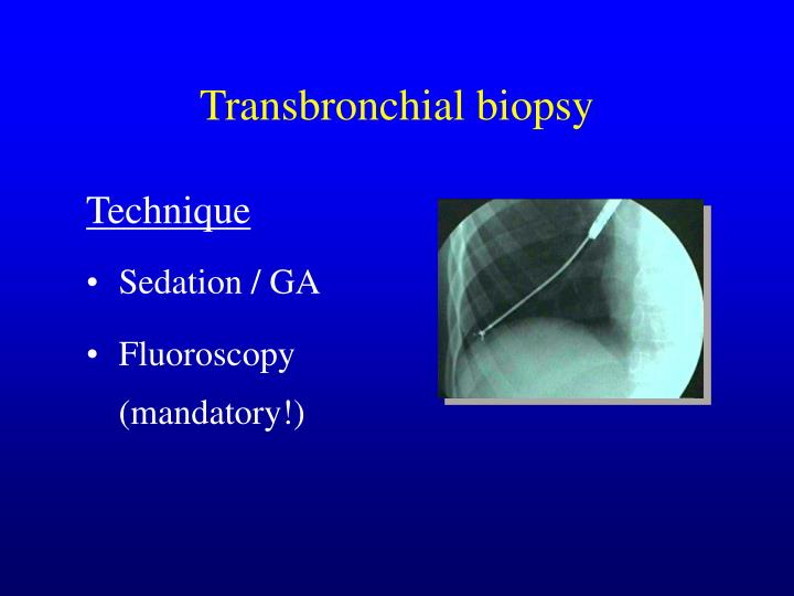 PPT - Lung biopsy (mucosal/transbronchial/open lung) Ernst Eber, MD ...