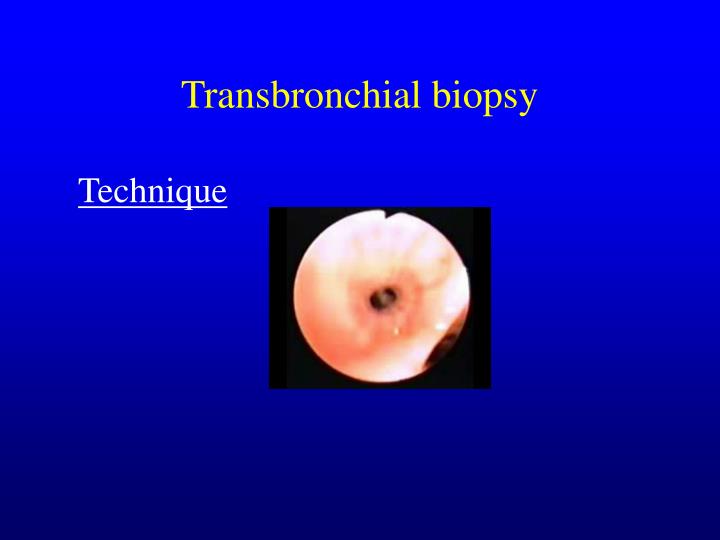 PPT - Lung biopsy (mucosal/transbronchial/open lung) Ernst Eber, MD ...