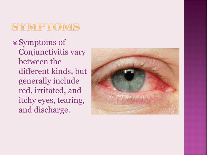 PPT - Conjunctivitis PowerPoint Presentation - ID:4607614