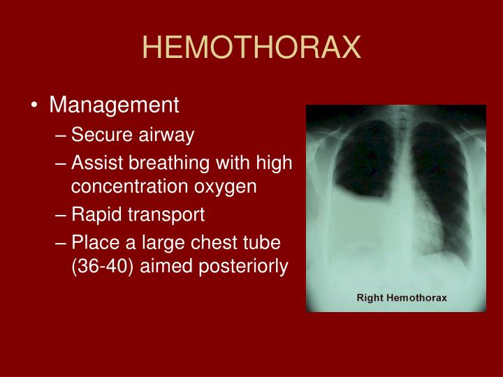 PPT - CHEST TRAUMA PowerPoint Presentation - ID:4611815