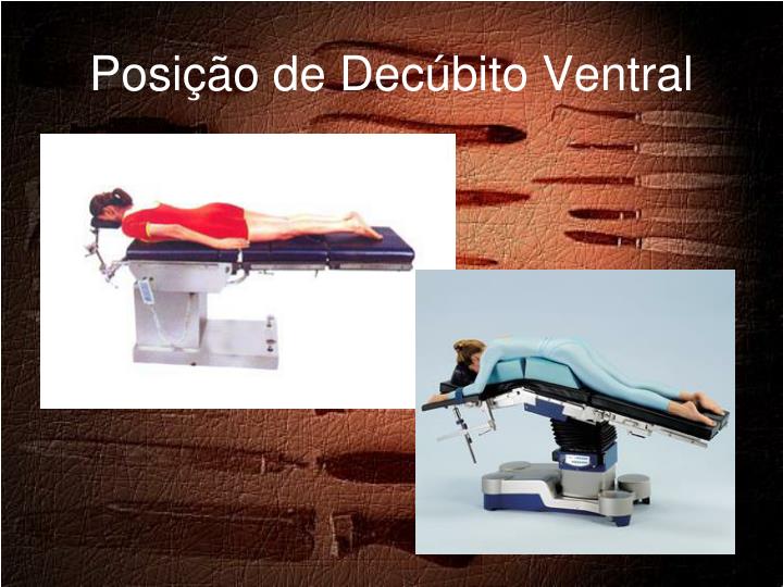 PPT - POSICIONAMENTO DO PACIENTE NA MESA OPERATÓRIA PowerPoint ...