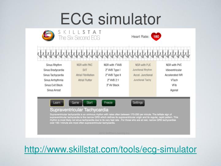 PPT - Recognizing Cardiac arrhythmias PowerPoint Presentation - ID:4613819