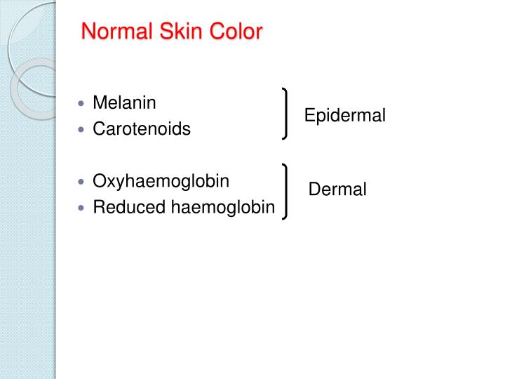 PPT - Vitiligo PowerPoint Presentation - ID:4615319