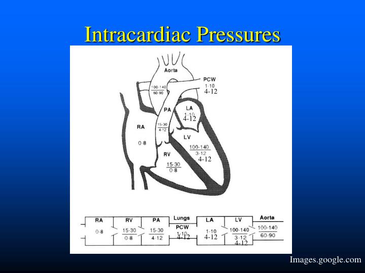 PPT - Diseases of the Pulmonary Circulation PowerPoint Presentation ...