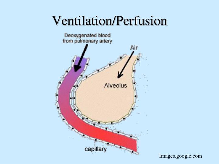PPT - Diseases of the Pulmonary Circulation PowerPoint Presentation ...