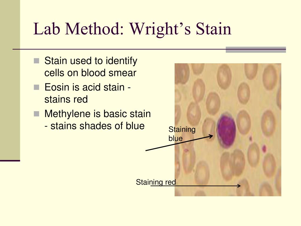 PPT - MLAB 1415- Hematology Keri Brophy-Martinez PowerPoint ...