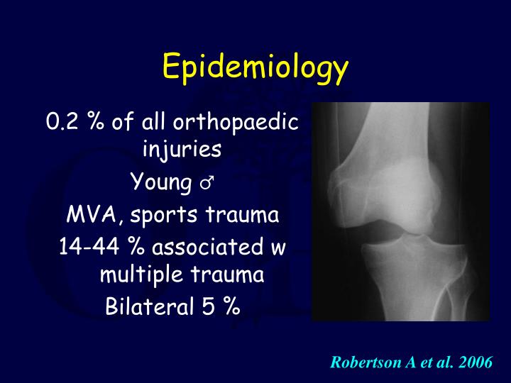 PPT - Knee Dislocation and Multiligamentous Injury PowerPoint ...