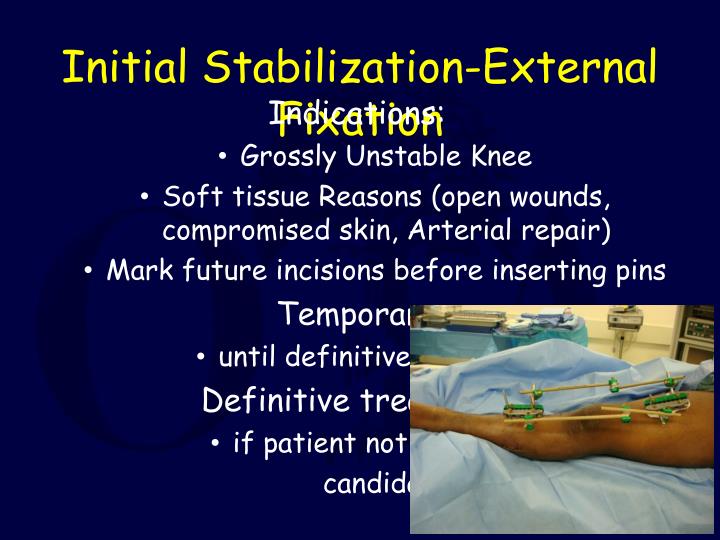 PPT - Knee Dislocation and Multiligamentous Injury PowerPoint ...