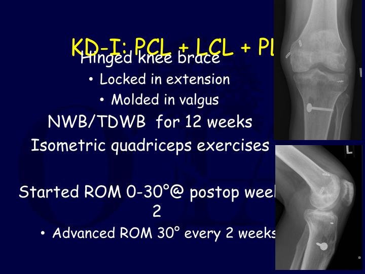 PPT - Knee Dislocation and Multiligamentous Injury PowerPoint ...