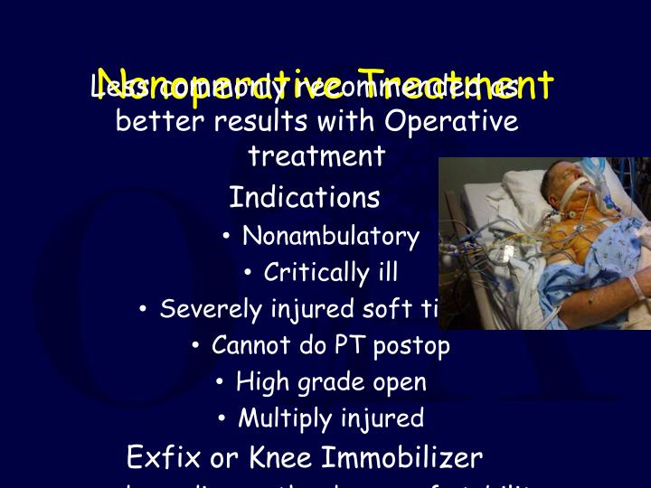 PPT - Knee Dislocation and Multiligamentous Injury PowerPoint ...