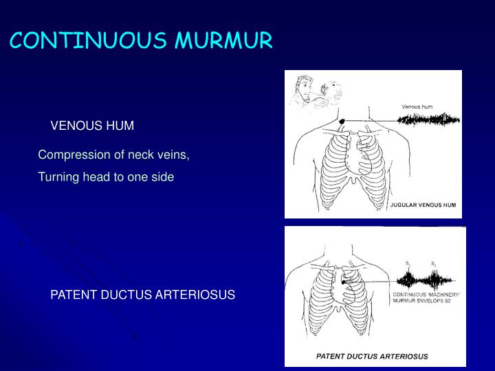PPT - DYNAMIC AUSCULTATION PowerPoint Presentation - ID:4623897