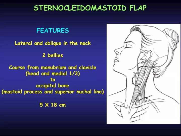 PPT - STERNOCLEIDOMASTOID FLAP PowerPoint Presentation, free download ...