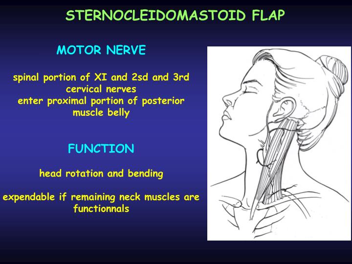 PPT - STERNOCLEIDOMASTOID FLAP PowerPoint Presentation - ID:4627833