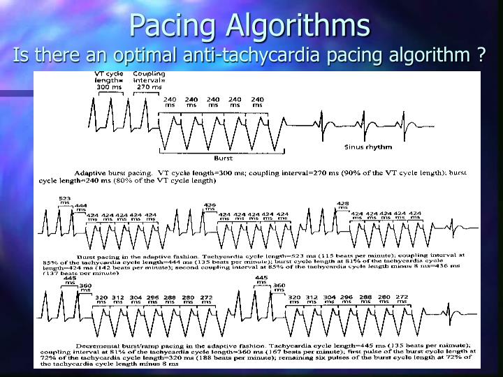 PPT - Physics of Cardiac Arrhythmias PowerPoint Presentation - ID:4628595
