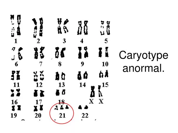 PPT - Caryotype anormal. PowerPoint Presentation, free download - ID ...