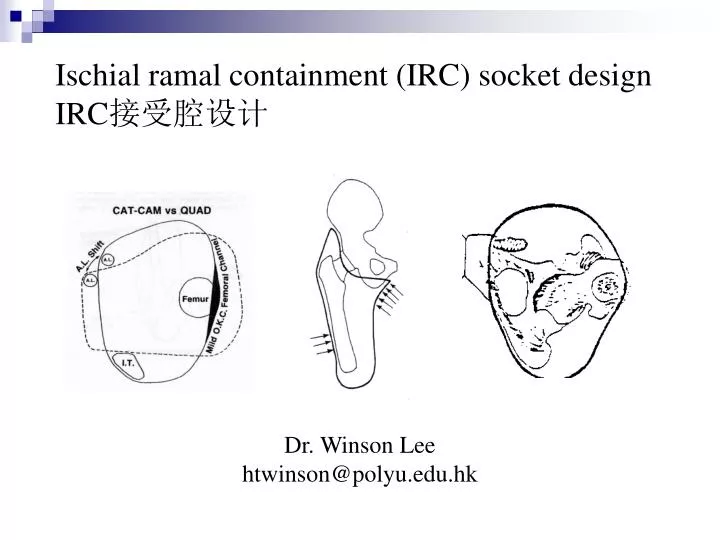 PPT - Ischial ramal containment (IRC) socket design IRC 接受腔设计 ...