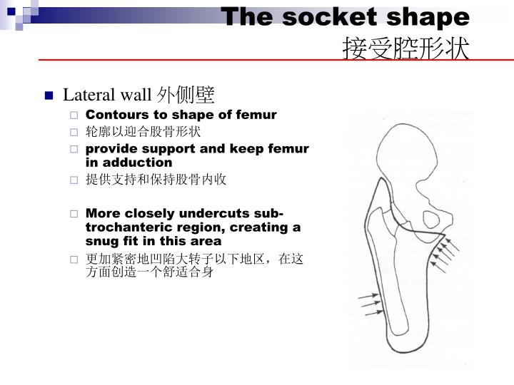 PPT - Ischial ramal containment (IRC) socket design IRC 接受腔设计 ...