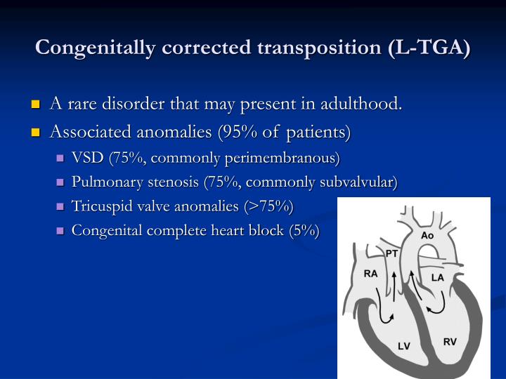 PPT - Transposition of the Great Arteries PowerPoint Presentation - ID ...