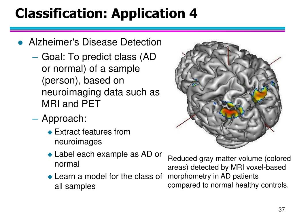 PPT - Machine Learning in BioMedical Informatics PowerPoint ... PPT - Machine Learning in BioMedical Informatics PowerPoint ...