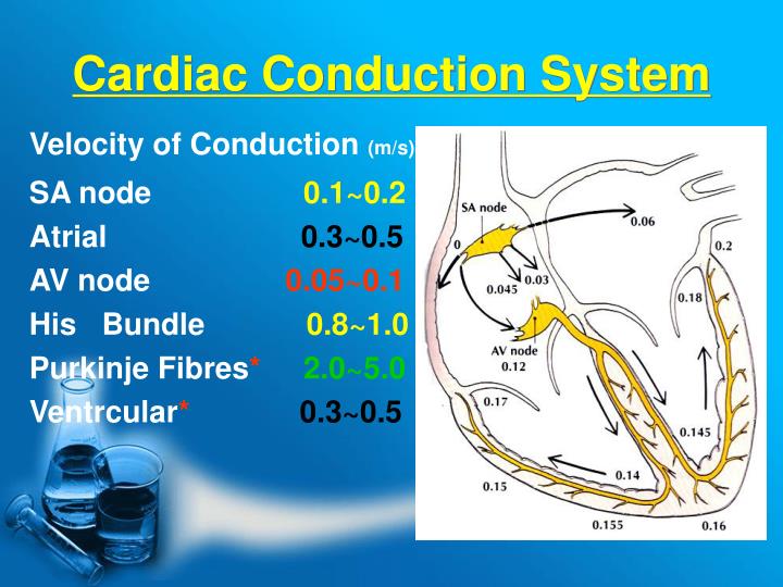 PPT - BIVENTRICULAR PACING PowerPoint Presentation - ID:4638971