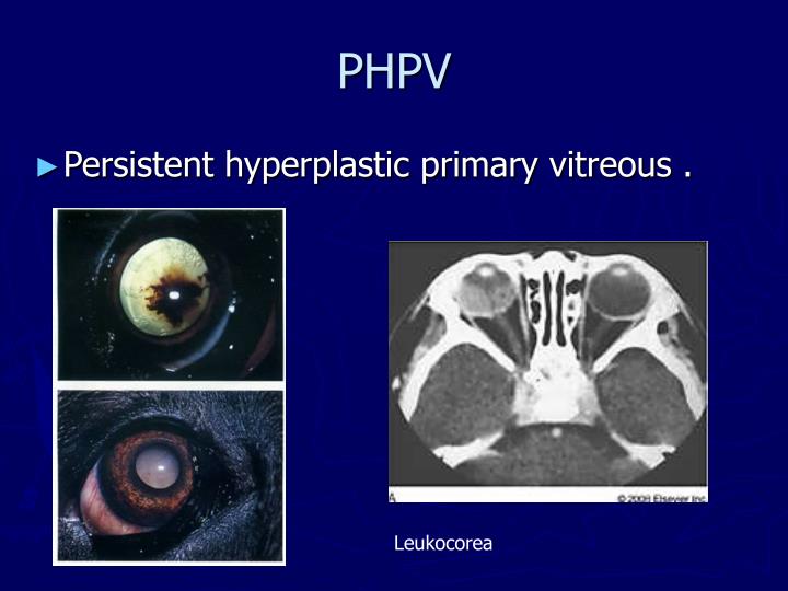 PPT - Pediatric Optometry PowerPoint Presentation - ID:4648684