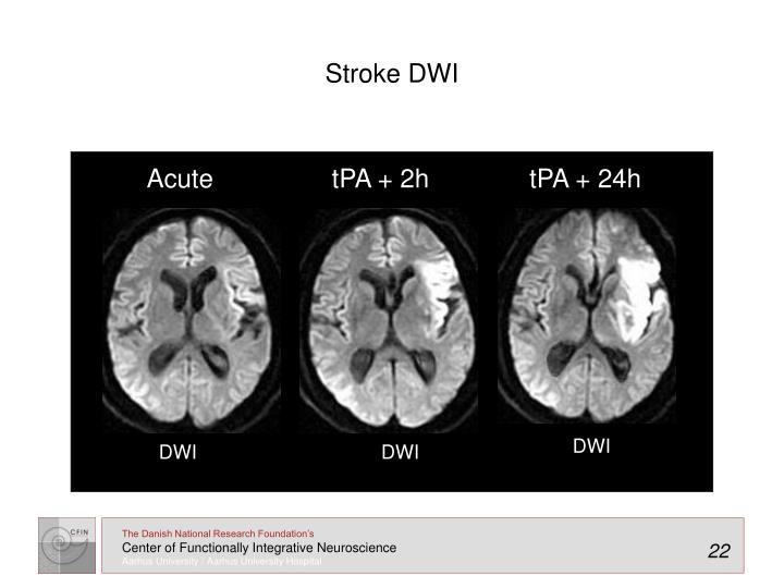PPT - Diffusion weighted MRI PowerPoint Presentation - ID:4649427