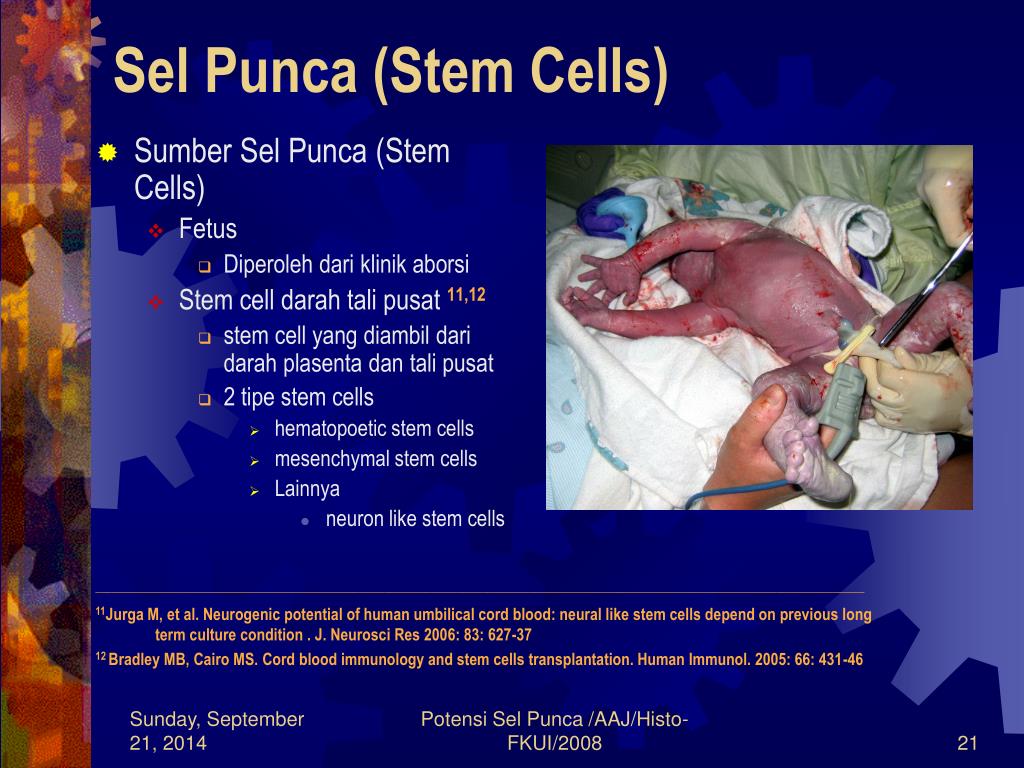 PPT - POTENSI SEL PUNCA (STEM CELL) UNTUK MEMPERBAIKI CACAT LAHIR DI ...