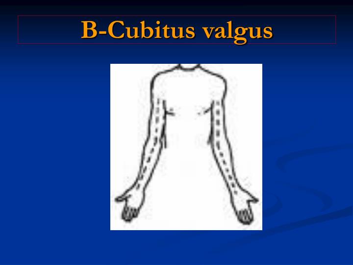 PPT - Deformities PowerPoint Presentation - ID:4675237