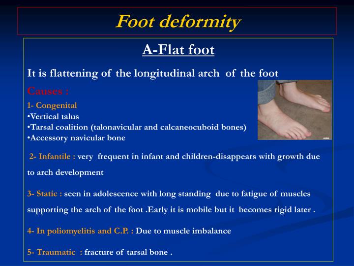 PPT - Deformities PowerPoint Presentation - ID:4675237