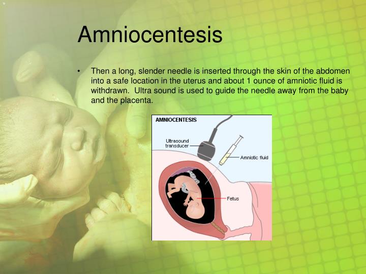 PPT - Childbirth Complications PowerPoint Presentation - ID:4681042