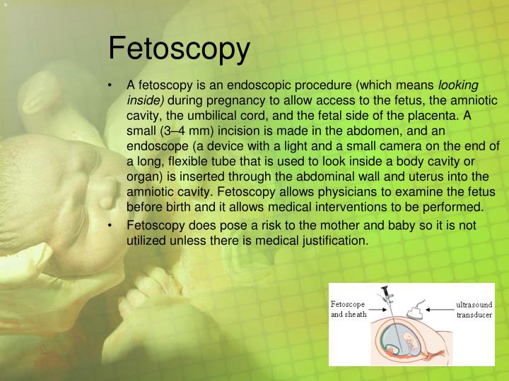 PPT - Childbirth Complications PowerPoint Presentation - ID:4681042