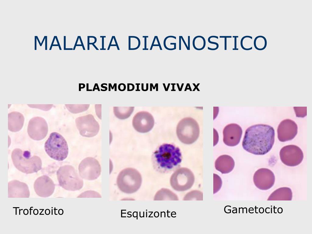 PPT - MALARIA Y DENGUE Claudia Cáterin Calderón P. Pediatra Clínica ...