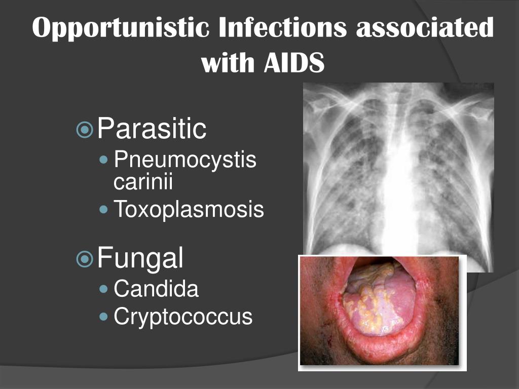 PPT - Priyo Budi Purwono, dr Kuliah Mikrobiologi PowerPoint ...