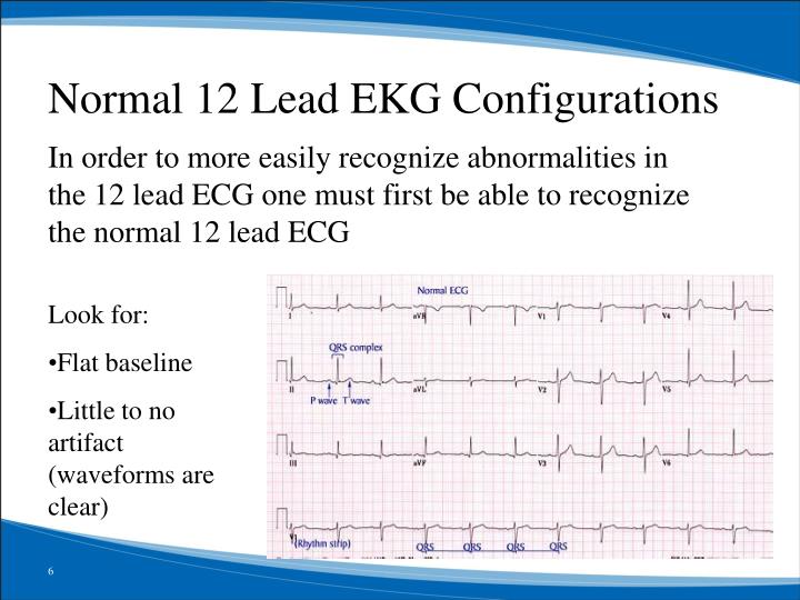 PPT - DIAGNOSTICS OF Acute Coronary Syndromes PowerPoint Presentation ...