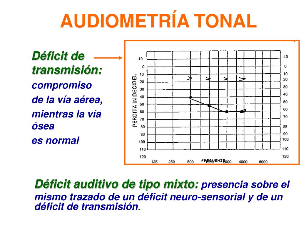 PPT - PATOLOGÍAS RELACIONADAS CON LA EXPOSICIÓN A RUIDO PowerPoint ...