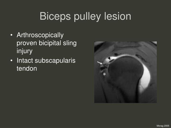 PPT - Anatomy and Pathology of the Rotator Interval PowerPoint ...