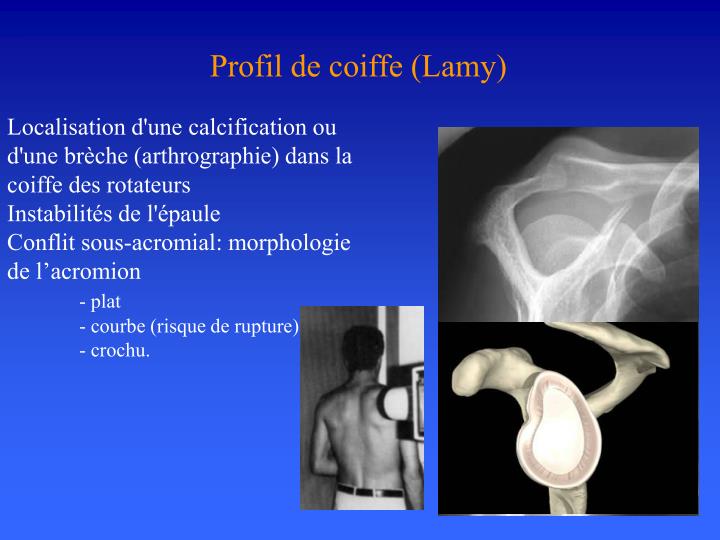 PPT - ANATOMIE RADIOLOGIQUE DE L’EPAULE PowerPoint Presentation - ID ...