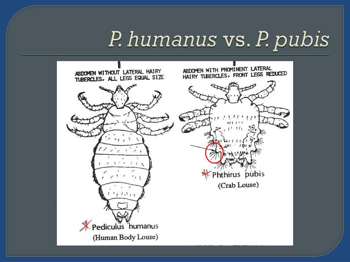 PPT - Fleas and Lice PowerPoint Presentation - ID:4702963