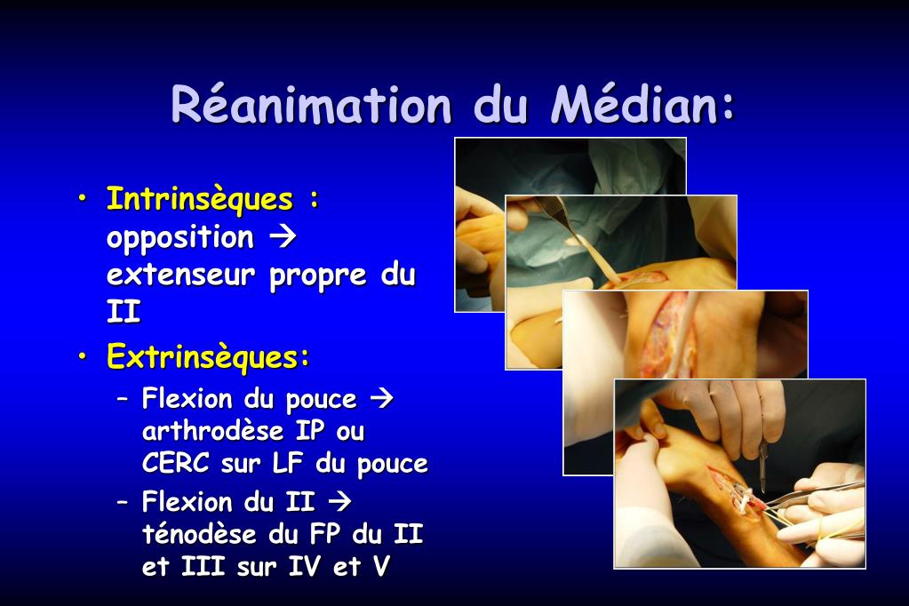 PPT - Place de la chirurgie palliative pour la main paralytique ...