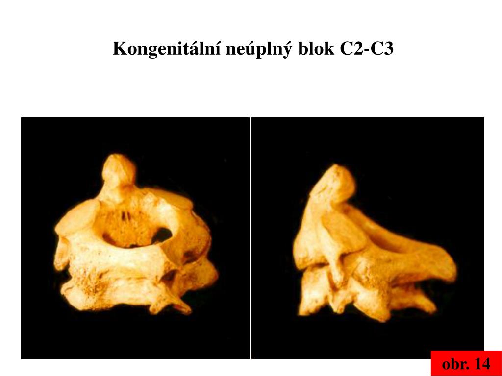 PPT - 1. Variety kostí lebky A . Variety na podkladě odchylek v ...