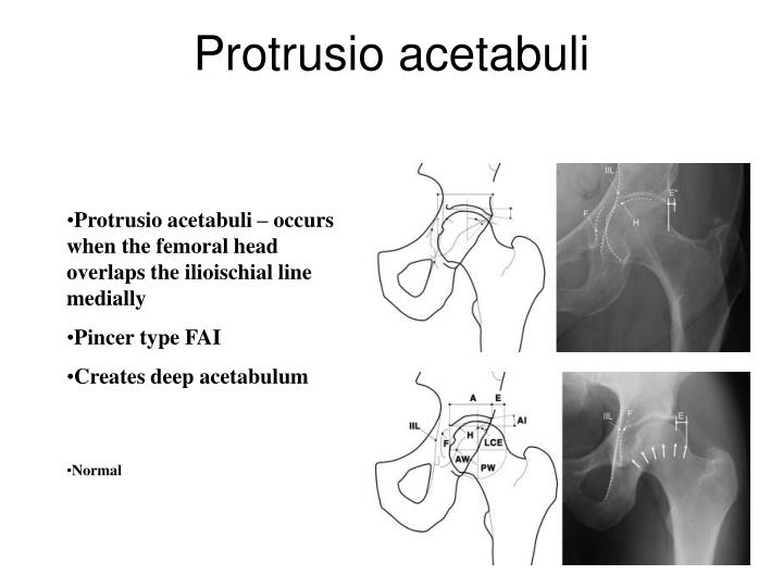 PPT - F.A.I. PowerPoint Presentation - ID:4709433