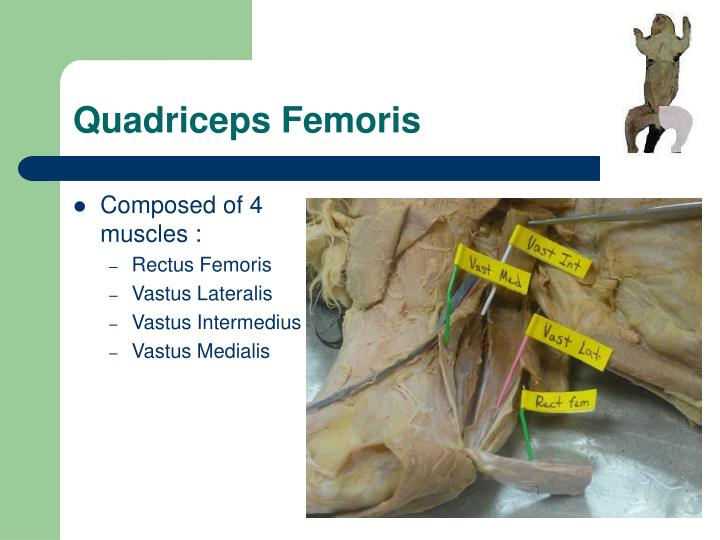 Quadriceps Femoris