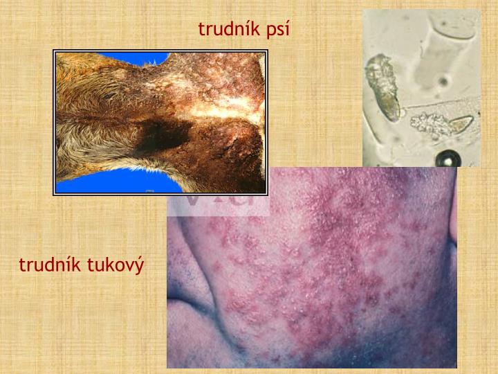 PPT - Roztoči PowerPoint Presentation - ID:4714481