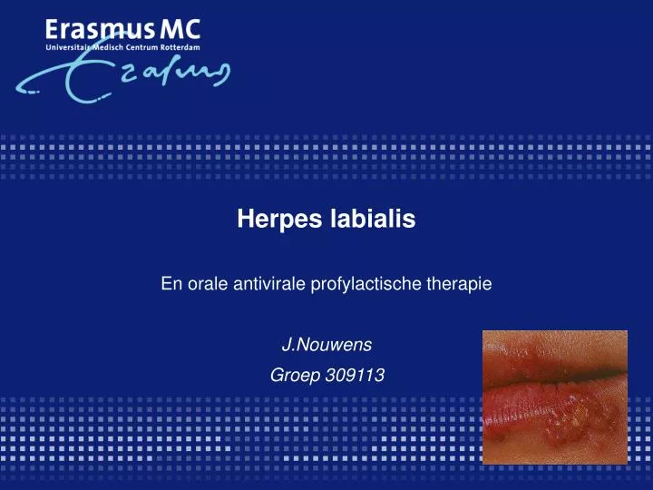 PPT - Herpes labialis PowerPoint Presentation, free download - ID:4724418