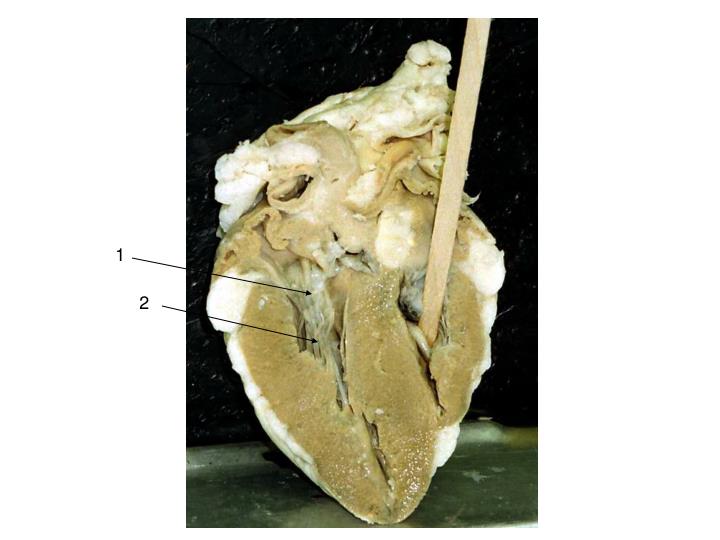 PPT - Fibrous pericardium / Pericardial sac PowerPoint Presentation ...