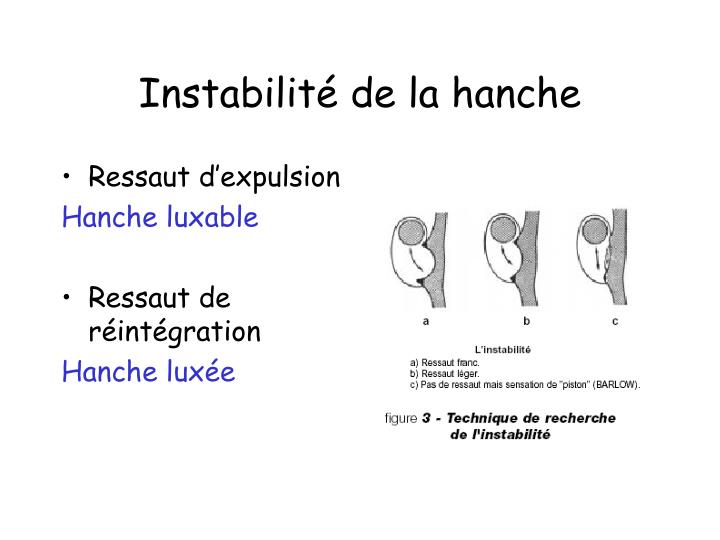 PPT - Examen clinique de l’enfant et du nourrisson PowerPoint ...