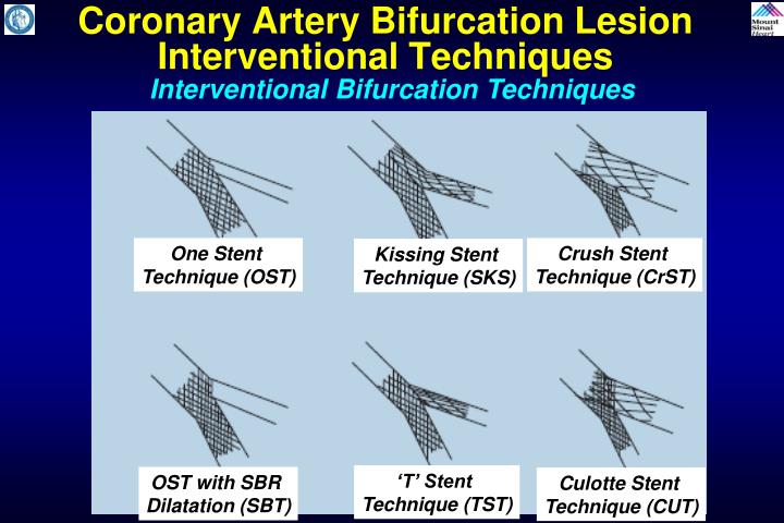 PPT - Complex Coronary Cases PowerPoint Presentation - ID:4727240