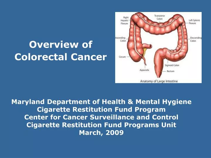 PPT - Overview of Colorectal Cancer PowerPoint Presentation, free ...