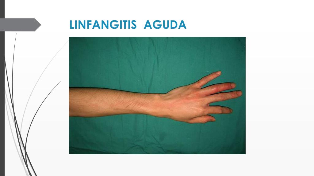 PPT - INFECCIONES BACTERIANAS DE LA PIEL Y TEJIDOS SUBCUTANEOS ...