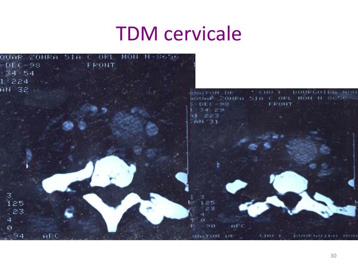 PPT - La chondrocalcinose articulaire PowerPoint Presentation - ID:4733686